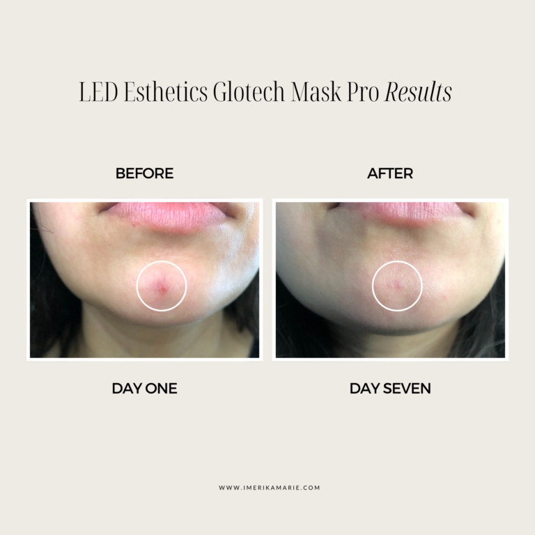 LED Esthetics Glotech Mask Pro Review | My Results + Discount Code ...