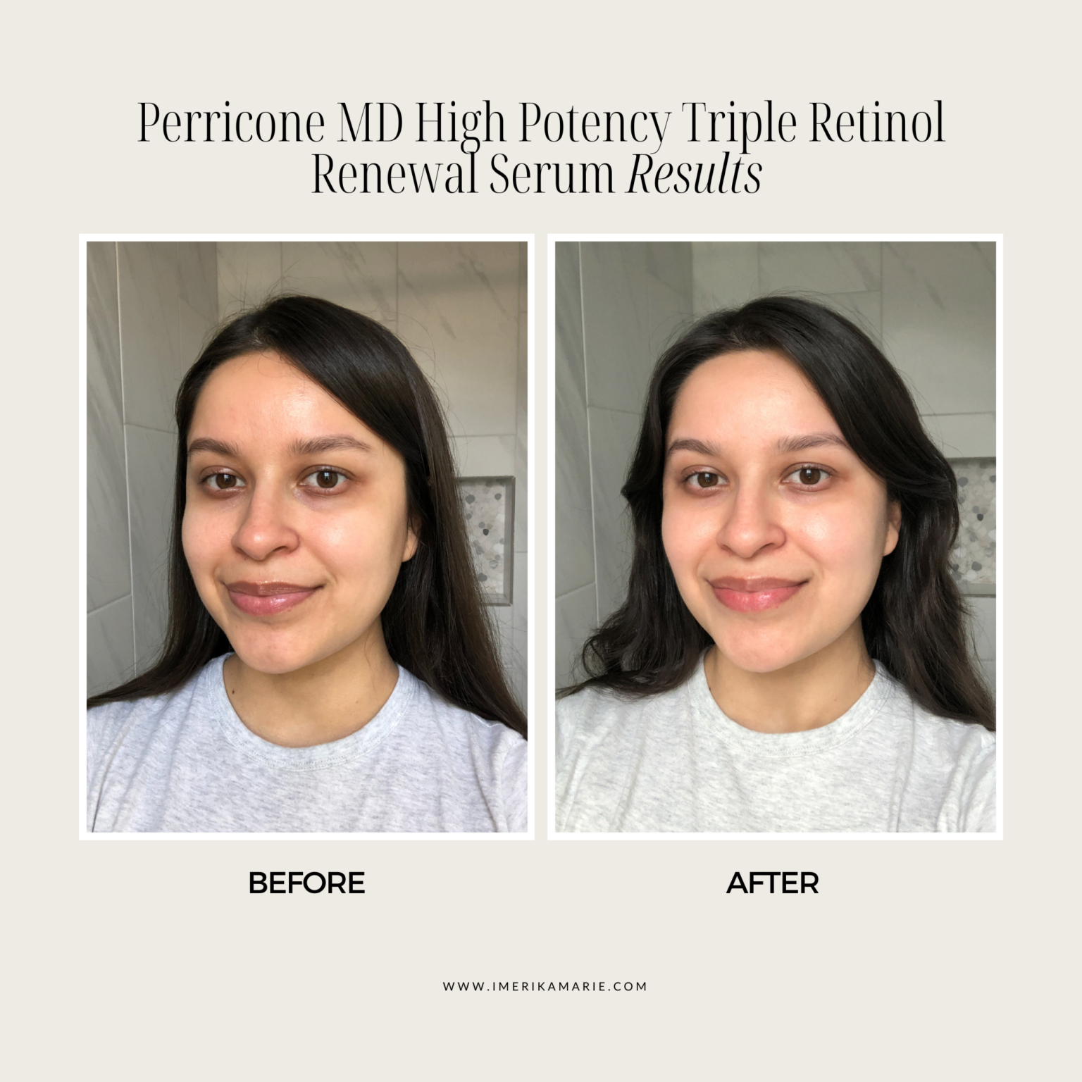 Perricone MD High Potency Triple Retinol Renewal Serums Review | My ...